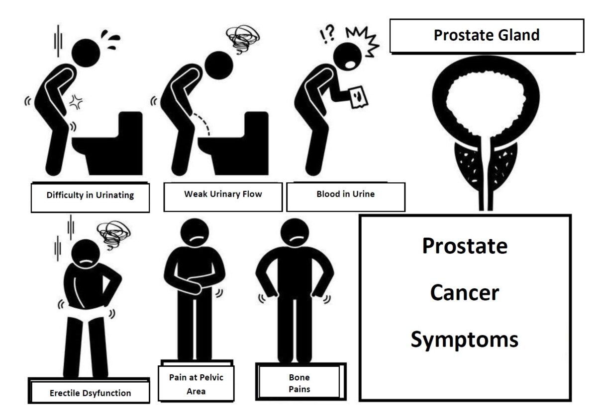 Prostate Cancer Symptoms: Early Warning Signs Men Should Never Ignore ...